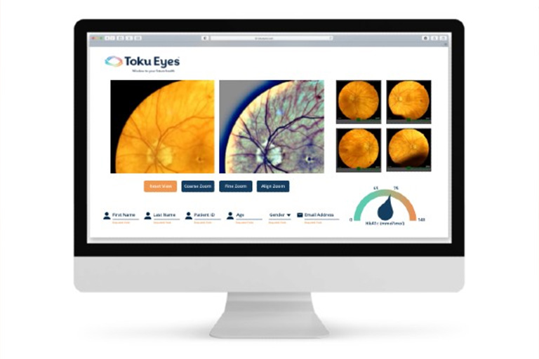 On a mission to democratize eyecare, Toku Eyes takes its technology to the U.S. - Toku